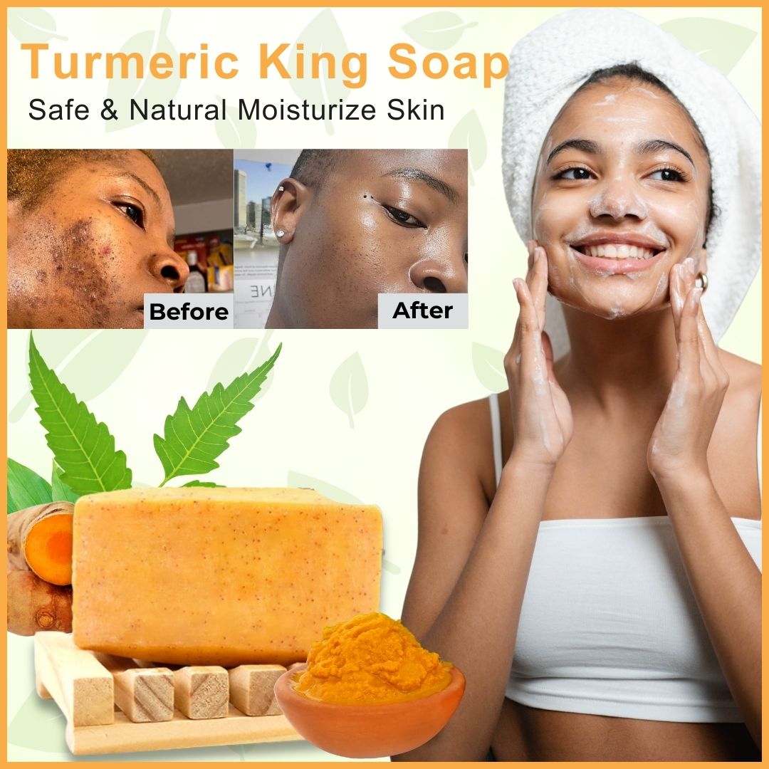 Organic Turmeric Soap for Radiant Skin – UGA MARKET